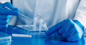 Different Types of Medical Swabs and the Uses