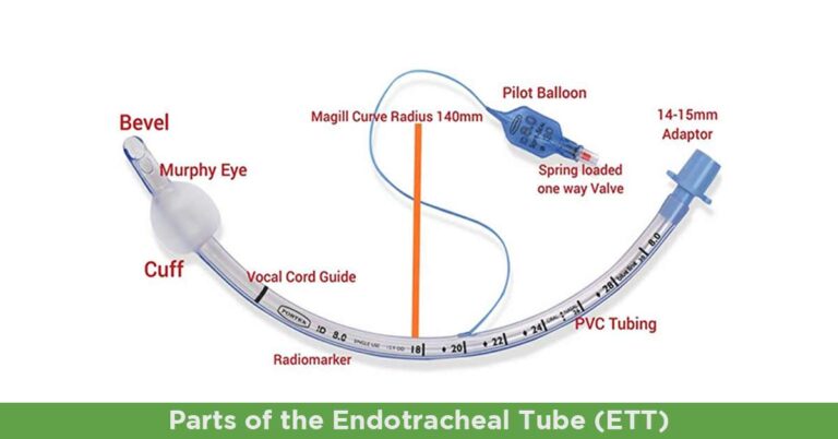 Types & Sizes of Endotracheal Tubes (ETT): Choice of ETT Sizes & Types
